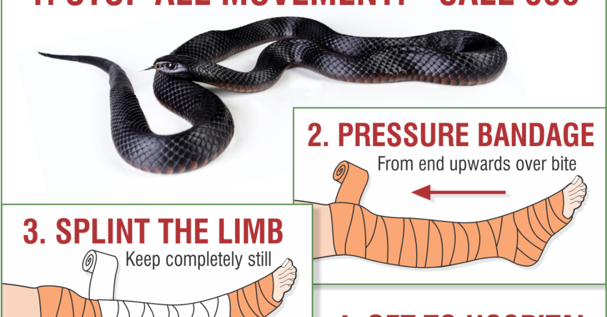First aid for a snake bite store